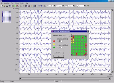 Myolab EMG high density array software